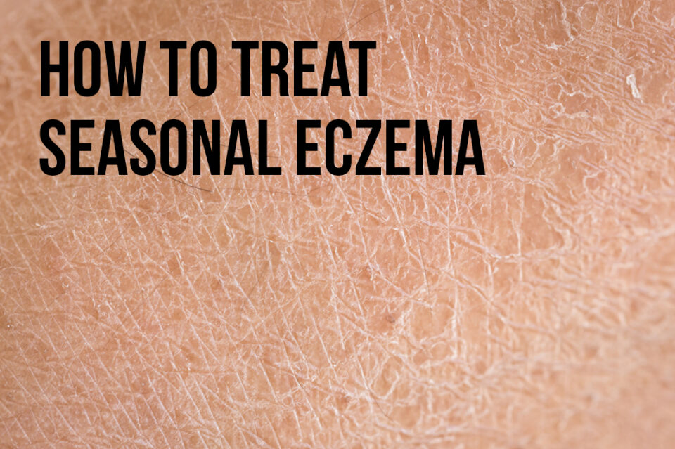 How to Prevent and Treat Seasonal Eczema - Alex Goes Global